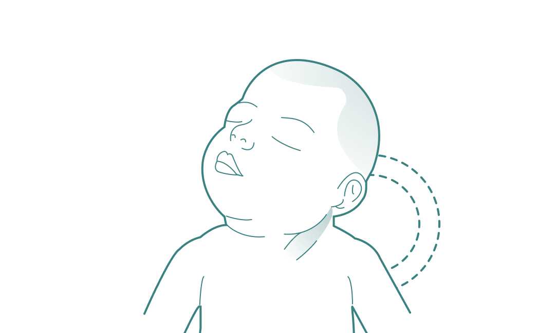 Quais são as causas do torcicolo congênito? - Instituto Fisit